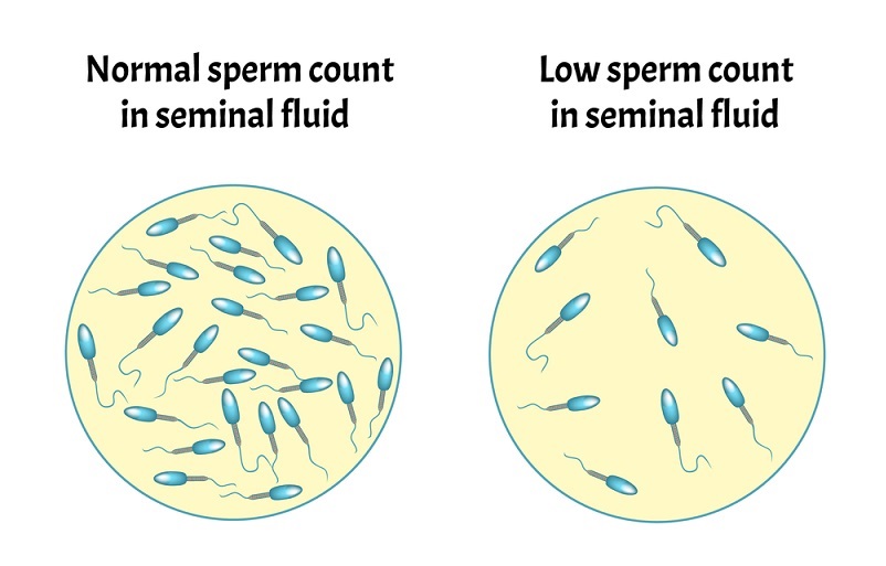 What Does It Mean When You Have A Low Sperm Count And What Causes This 
